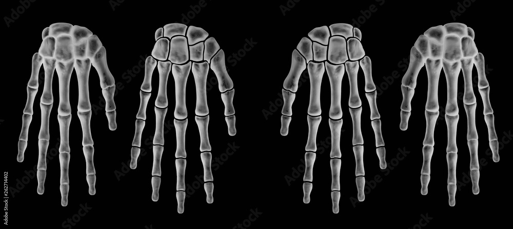 X-ray of human hand bone with Separate hand bone anterior view -3D ...