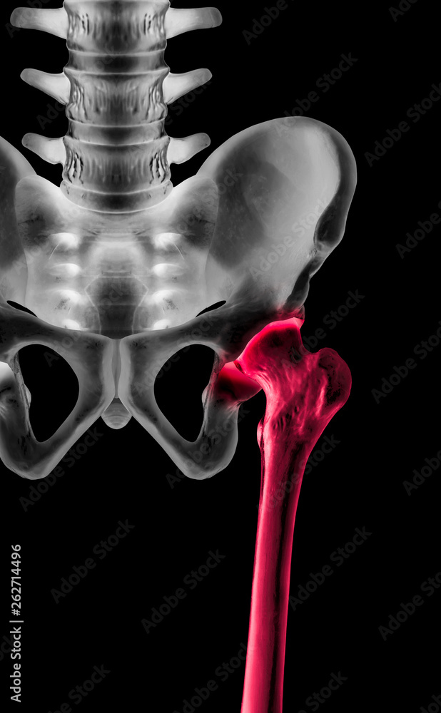 X-ray of lower half length human skeleton anterior view red highlight ...