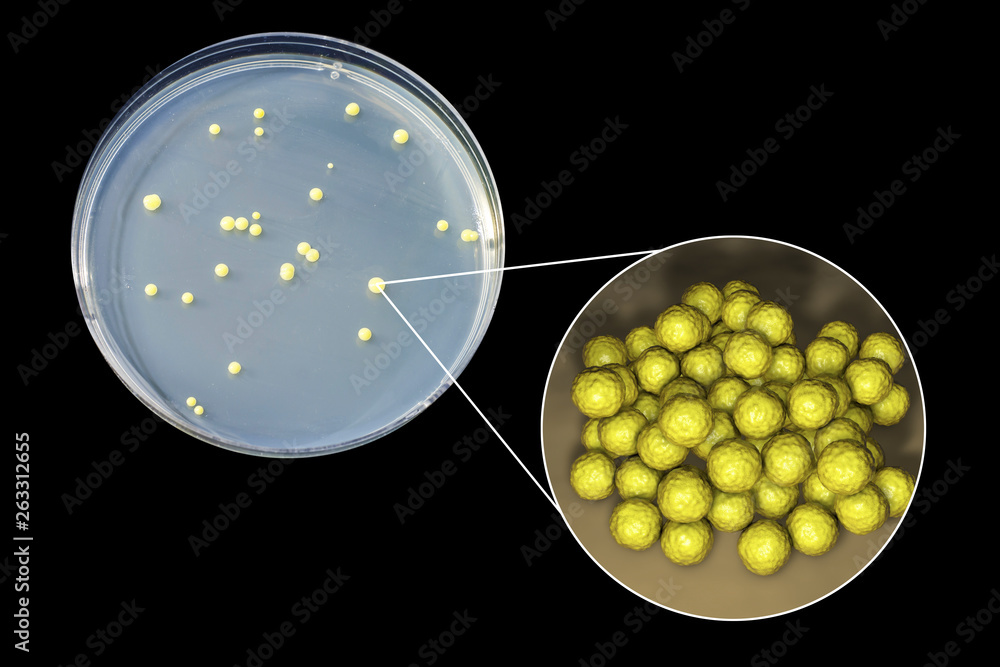Colonies of Micrococcus luteus bacteria on agar plate and close up view ...