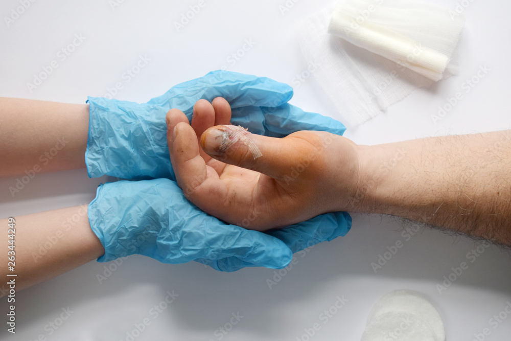 Doctors hands holding male hand with bloody gash on big finger. Doctor ...