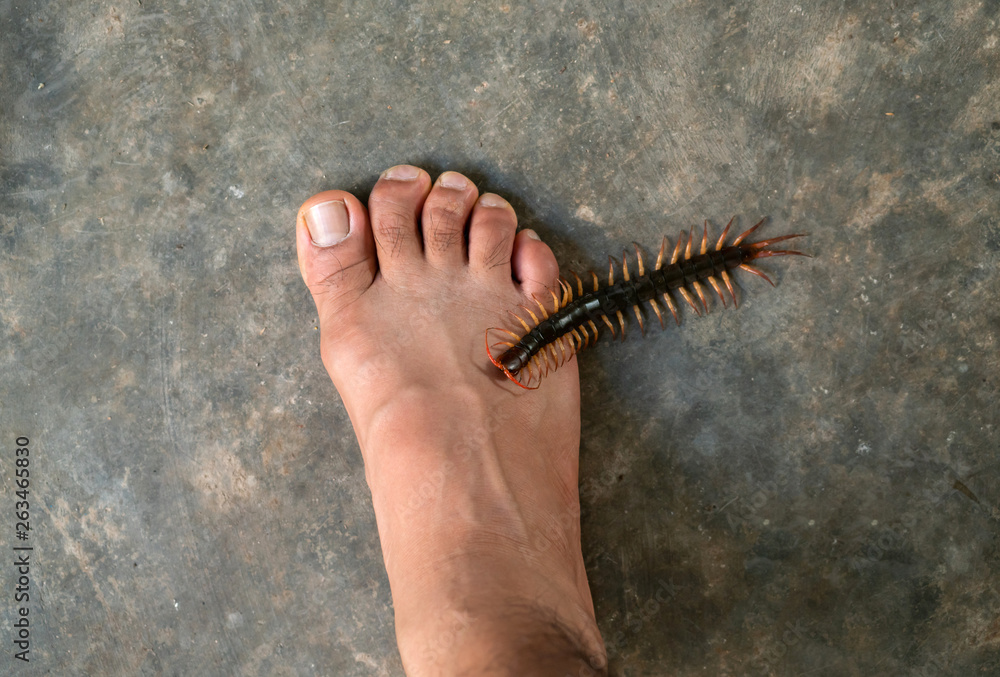 People were bitten by a centipede on their feet Stock Photo | Adobe Stock
