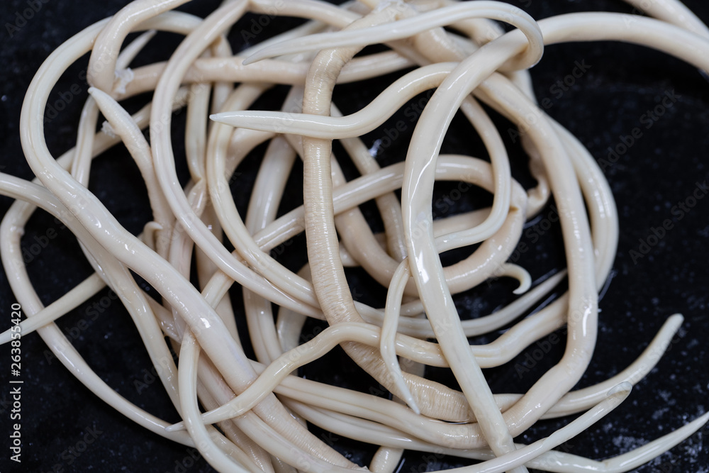 Ascariasis is a disease caused by the parasitic roundworm Ascaris ...