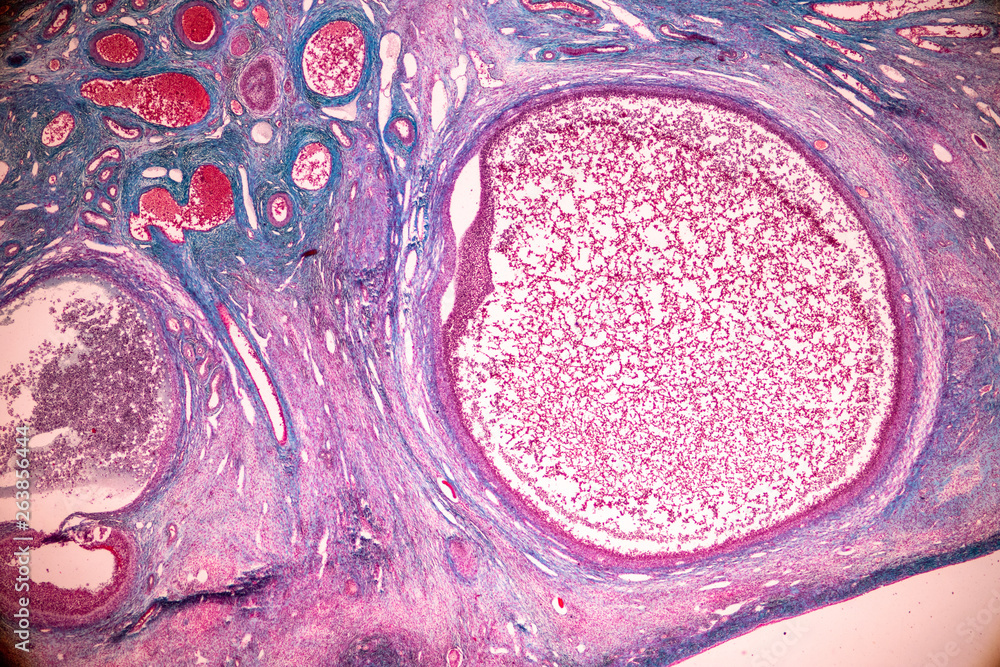 Student learning anatomy and physiology of Ovary under the microscopic ...