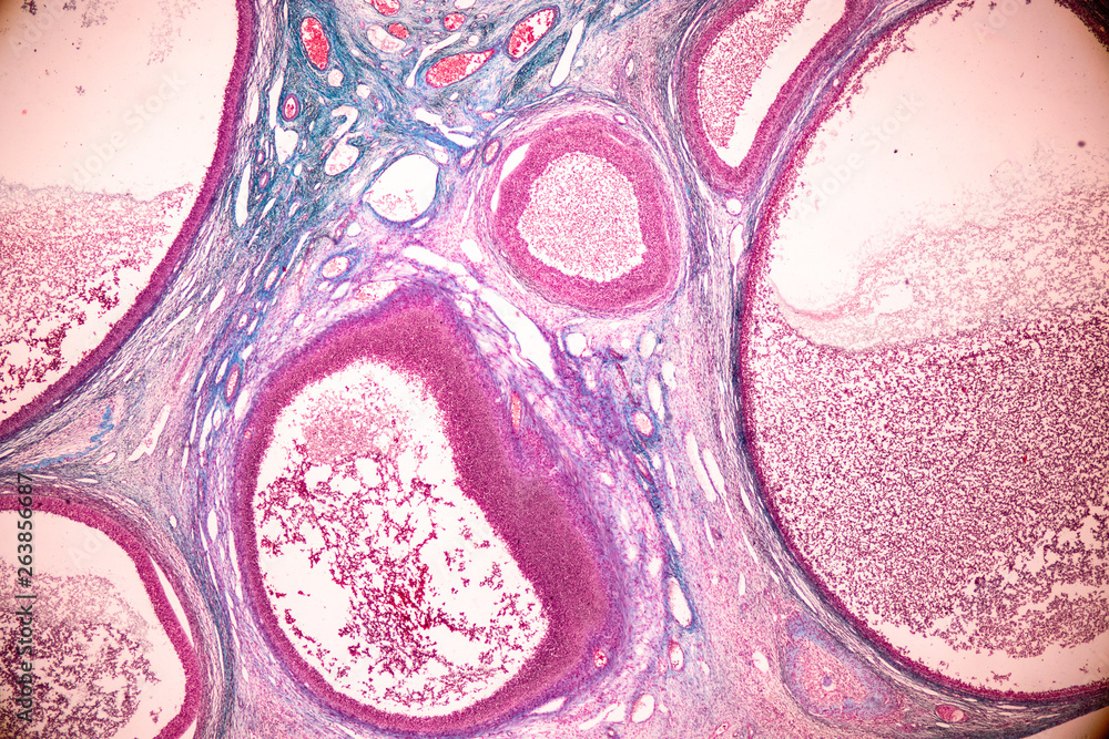 Student learning anatomy and physiology of Ovary under the microscopic ...