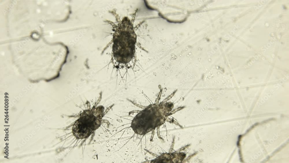 a granary or flour mite under a microscope, the name Acaroidea, Acarus ...