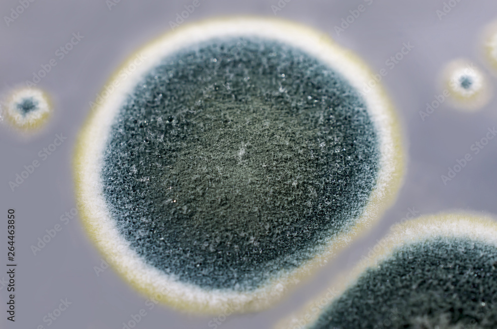Colonies of Penicillium fungi grown on Sabouraud Dextrose Agar ...