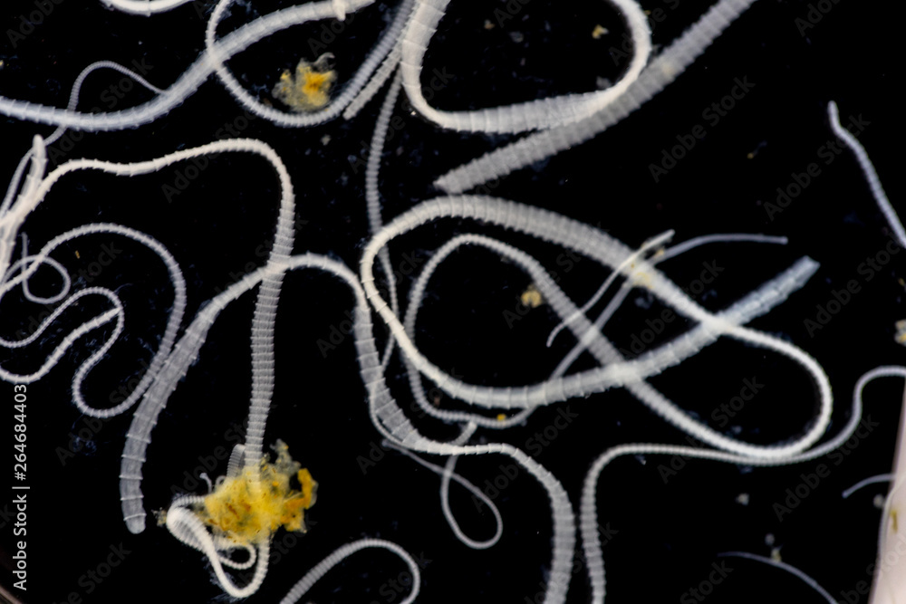 The study of Tapeworm infection is caused by ingesting food or water ...