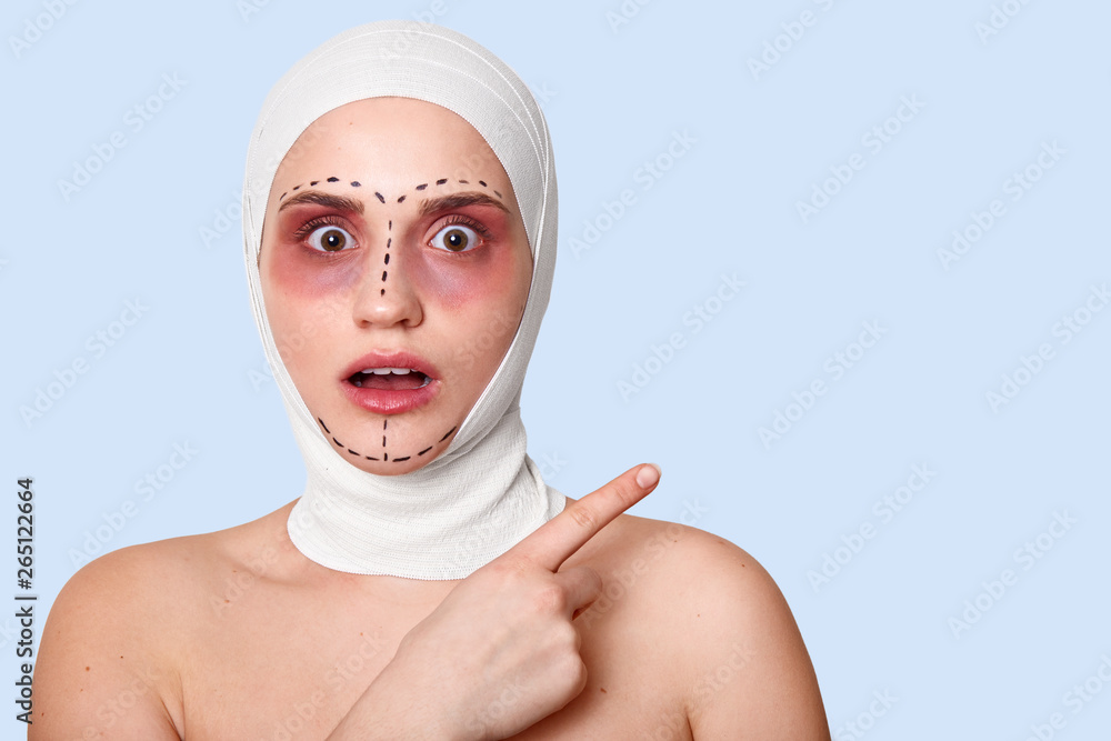 Beautiful woman before plastic surgery with bandaged face. Girl looks ...