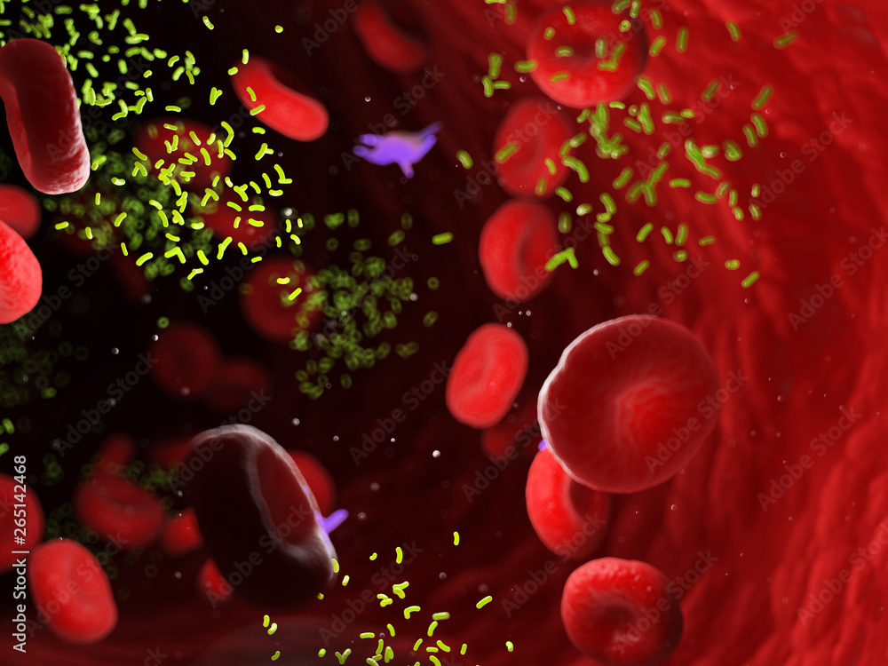 3d rendered medically accurate illustration of bacterias in an artery ...
