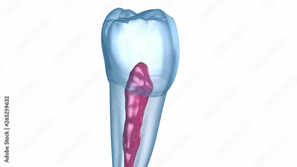 Dental root anatomy - Mandibular Second premolar tooth. Medically ...