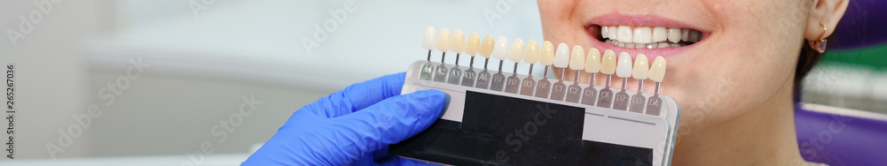 Dentist with tooth color samples is choosing shade for women patient ...