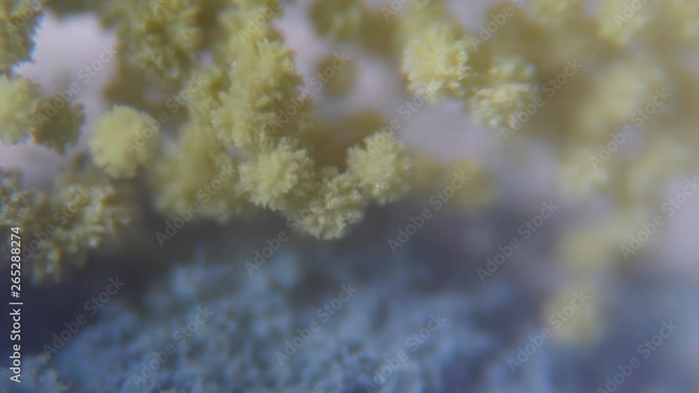 Mold under the microscope. GMO. DNA. Black Mold taken from rotten bread ...