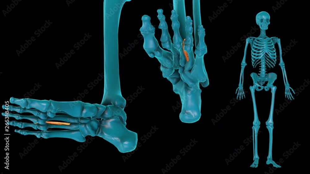Second plantar interosseous of foot--3D HUMAN MUSCLE ATLAS Stock Video ...