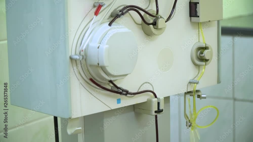 Plasmapheresis. Cleaning the patient s blood through the device. The ...