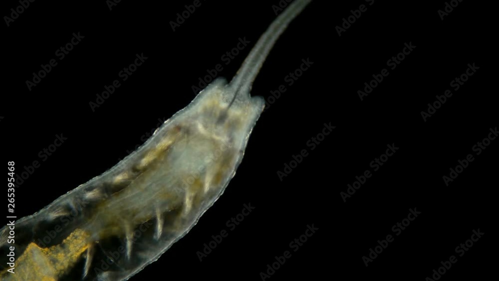 worm of the family Naididae under a microscope, the lower part of the ...