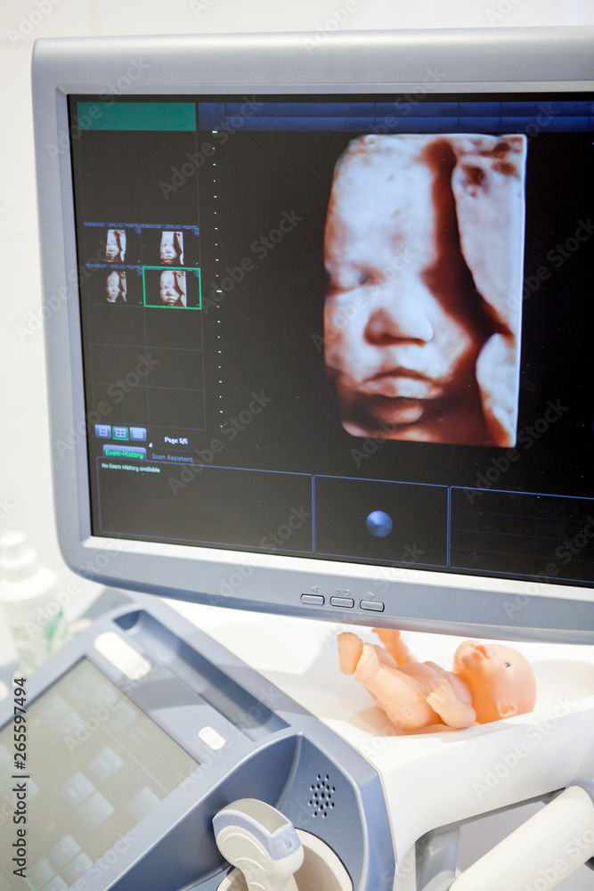 Model of image of mature fetus is on ultrasonographer monitor screen ...
