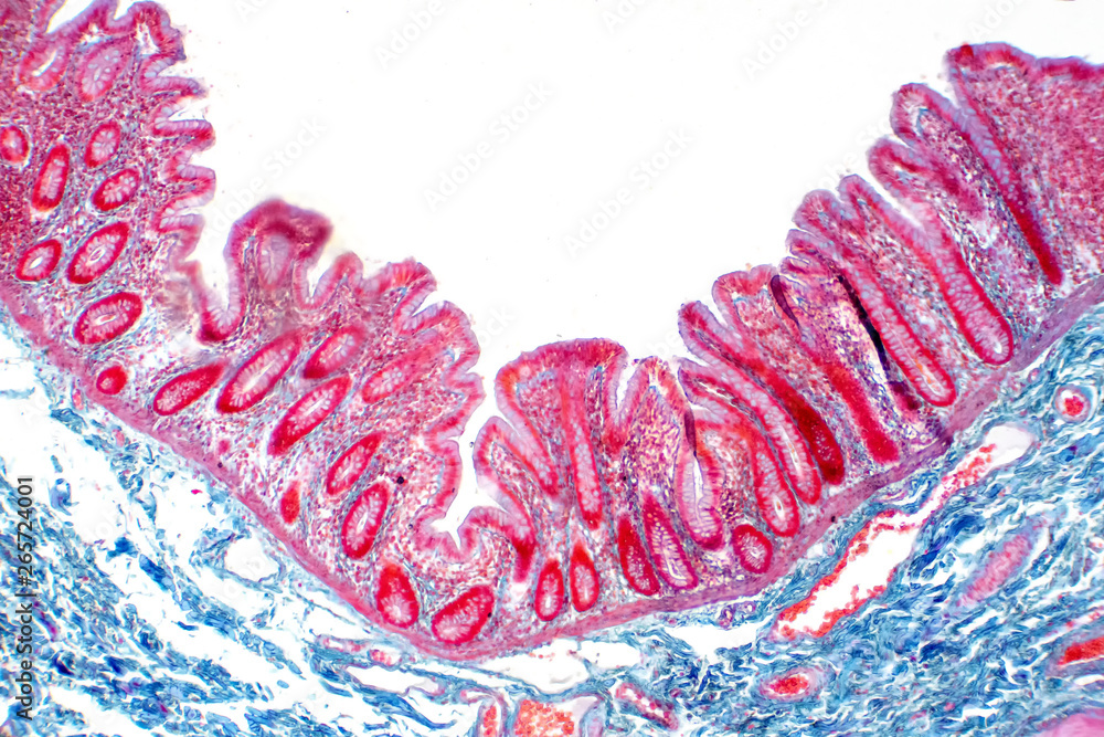 Human large intestine tissue under microscope view. Stock Photo | Adobe ...