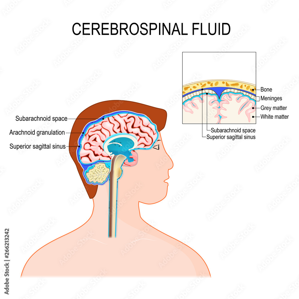 Cerebrospinal Fluid Analysis:- Part Cerebrospinal Fluid, 43% OFF Cerebrospinal Fluid Analysis:- Part Cerebrospinal Fluid, 43% OFF