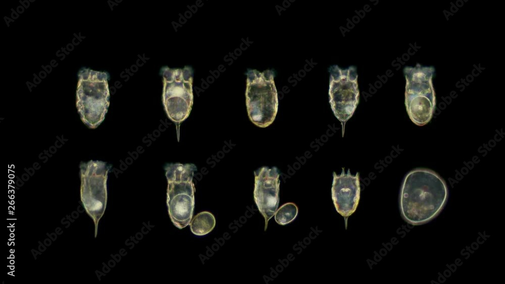 Stockvideon Rotifera Keratella Cochlearis under the microscope ...