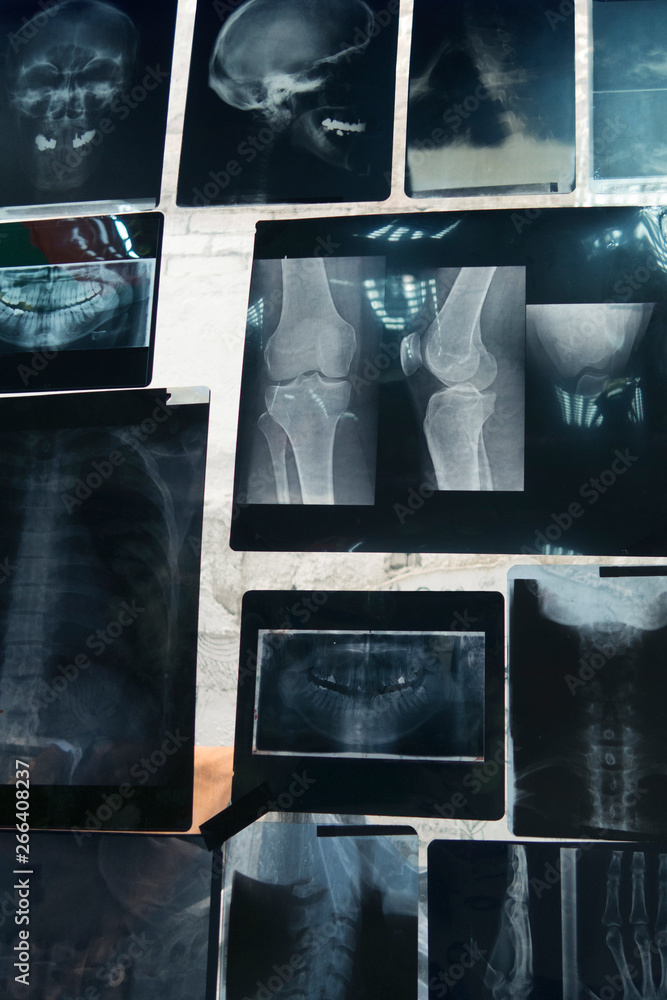 x-rays background Stock Photo | Adobe Stock