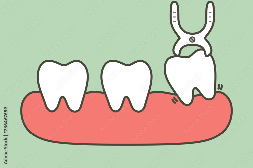 tooth extraction by dental tools to remove wisdom tooth - teeth cartoon ...