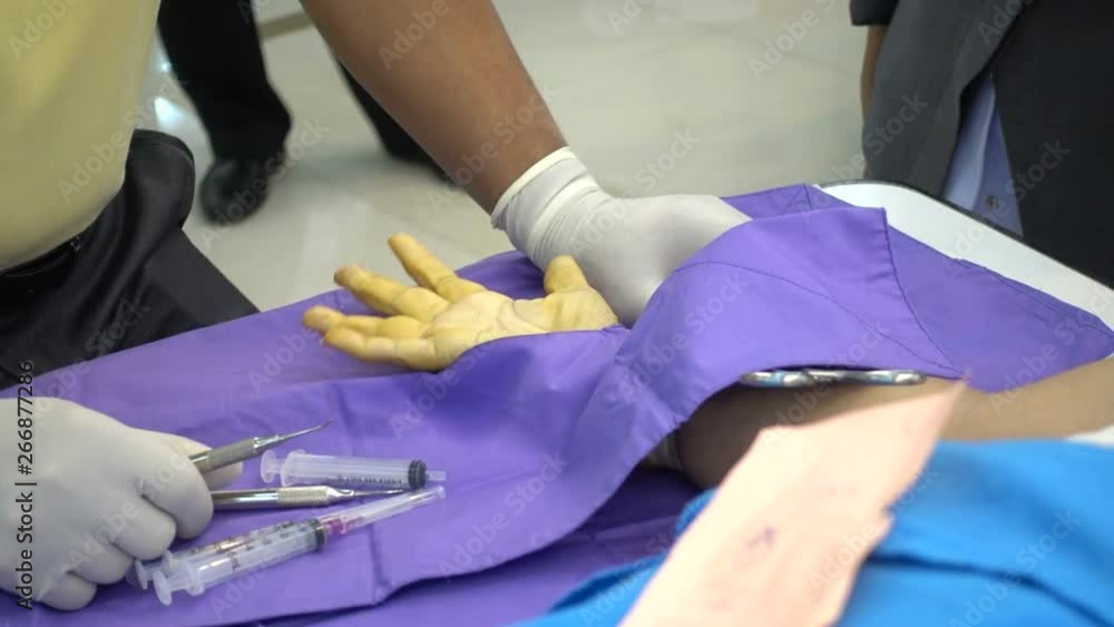 Trigger finger operation. Medical treatment , Digital flexer ...