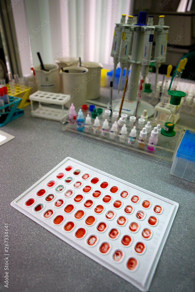Tablet to determine the blood group in the laboratory Stock Photo ...