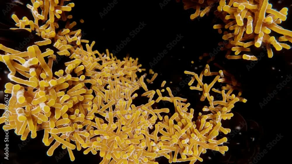 Tuberculosis bacillus in the lung. Tuberculosis is an infectious ...