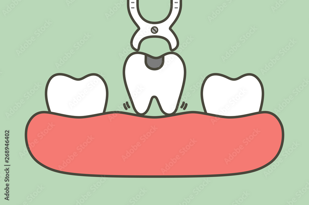 tooth extraction by dental tools to remove decay tooth - teeth cartoon ...