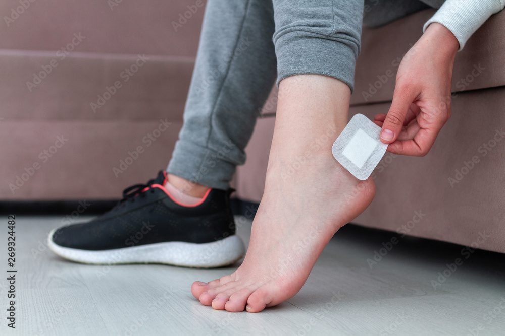 Using bactericidal medical adhesive plaster at home during wearing new ...