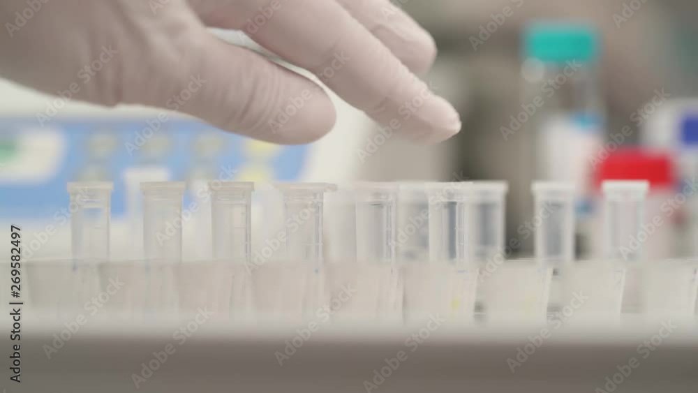 A close-up of lab technician taking a mini test tube with human ...
