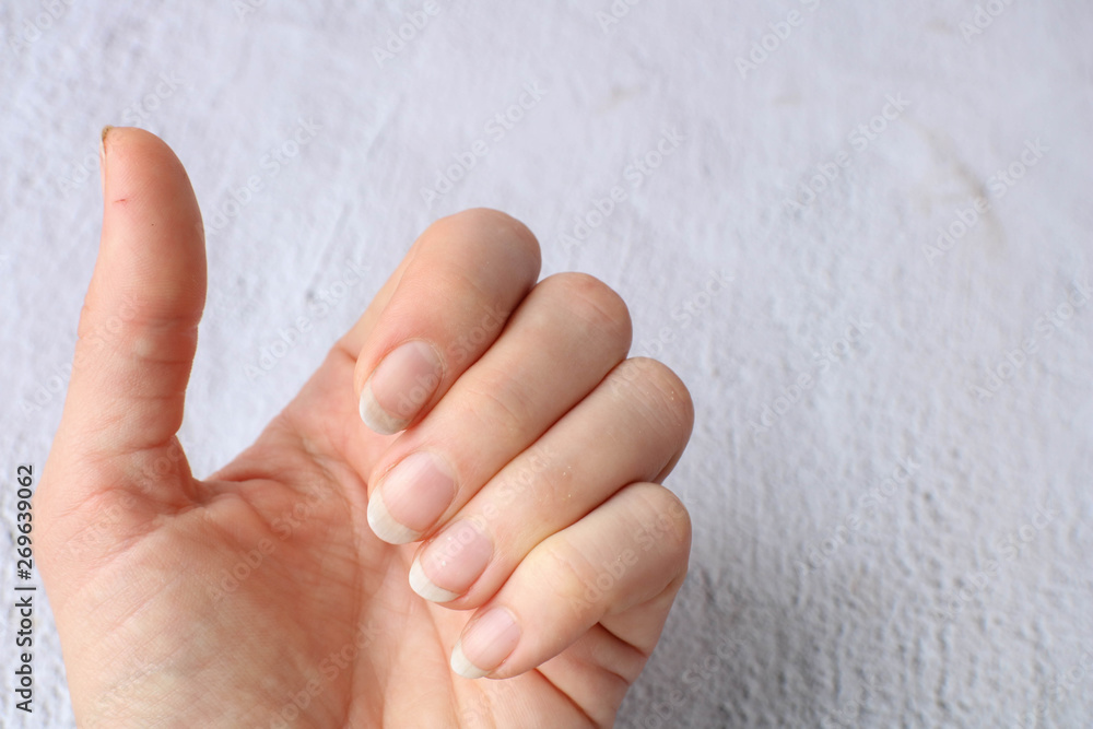 Close up dirty hand nails on white background have copy space for put ...