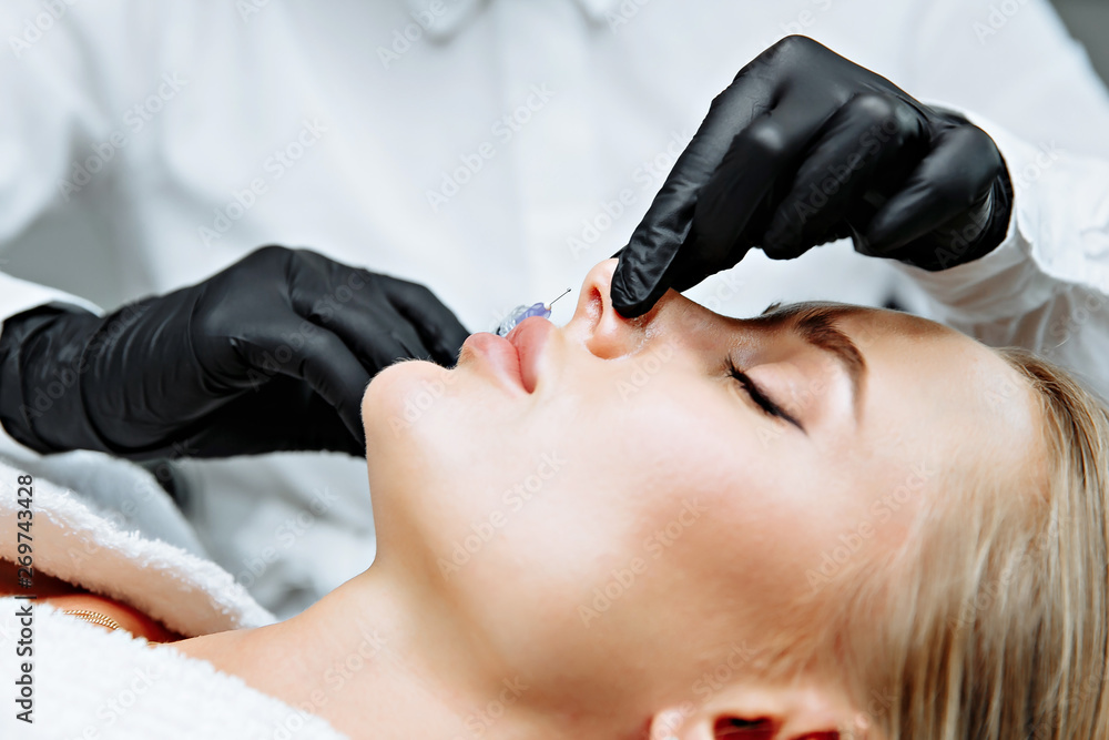 The doctor cosmetologist makes prick in the nose to correct the hump of ...