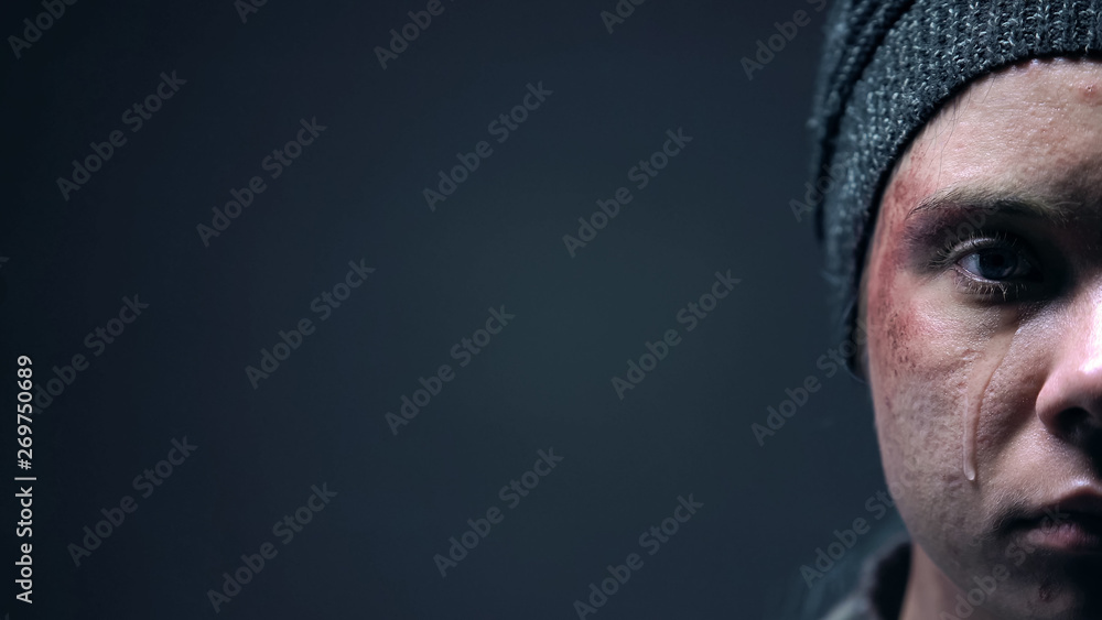 Half-face of injured crying person on dark background, cruelty and ...