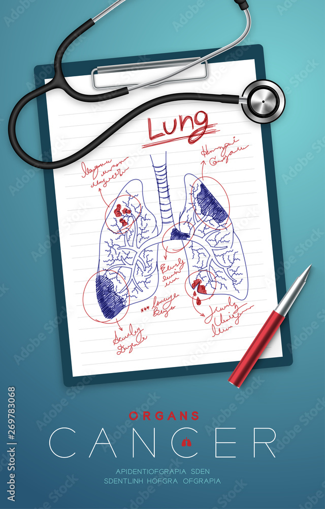Lung Cancer and infection, Doctor writing and hand sketch drawing on ...