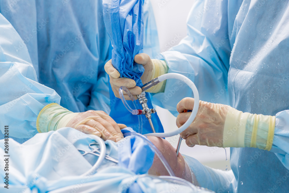 Arthroscope surgery. Orthopedic surgeons in teamwork in the operating ...