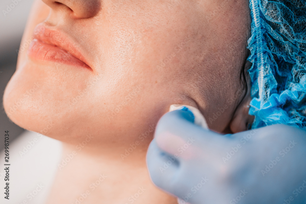 Painless and safe intradermal injections are effective for correcting ...