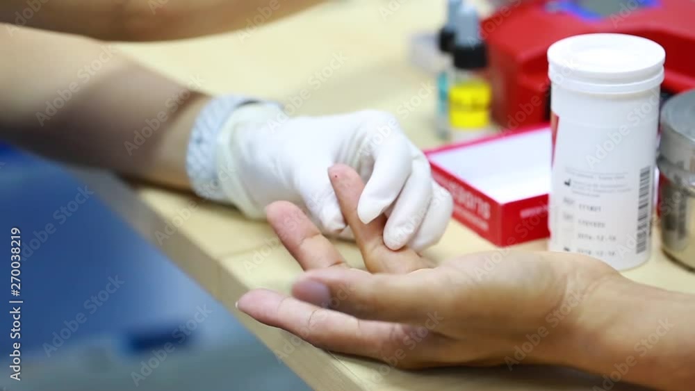 Punching blood group for easy separation. Blood collection to bring it ...