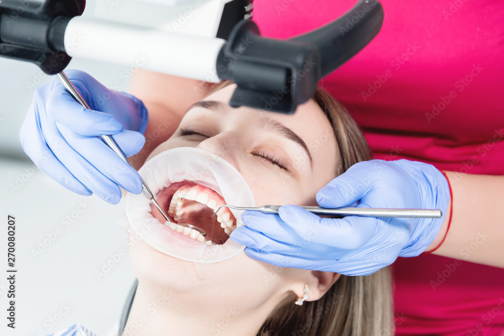 A close-up of the girl's face is examined by a dental examiner with his ...