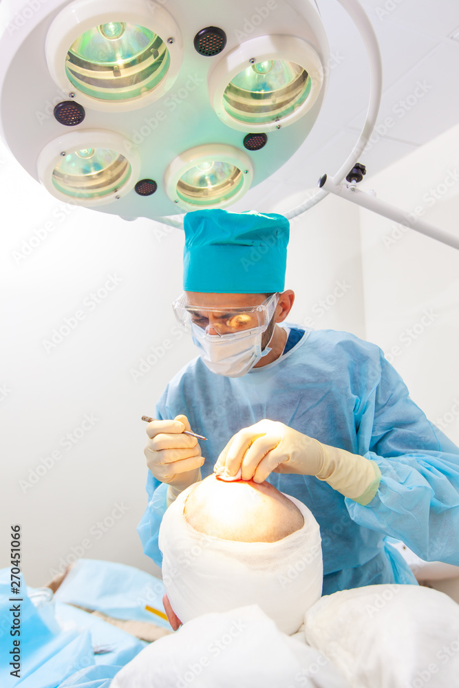 Baldness treatment. Hair transplant. Surgeons in the operating room ...