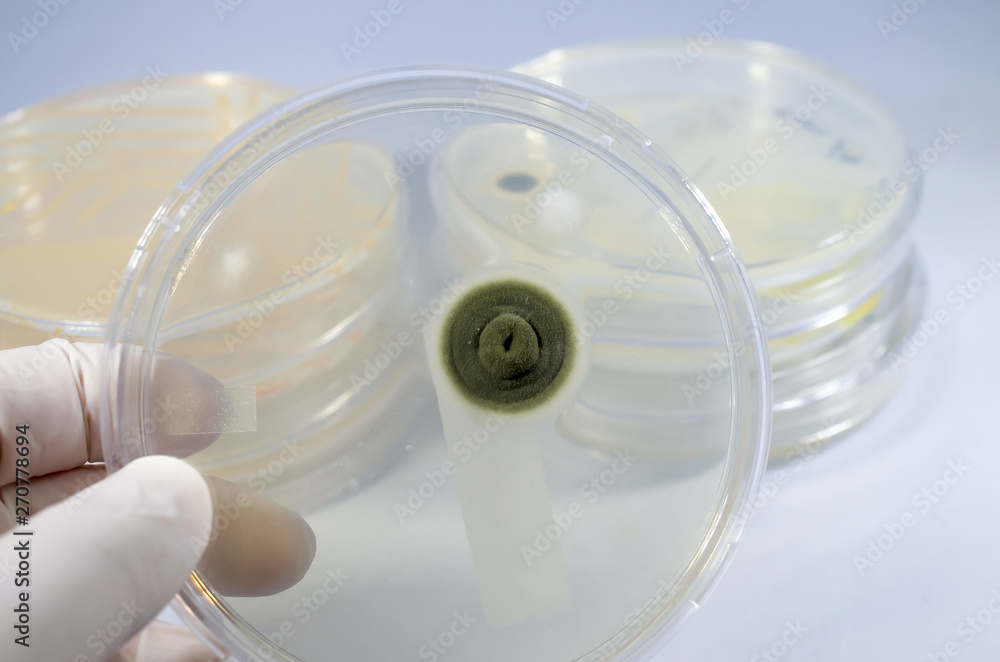 Colony of Alternaria mold fungus cultivated from indoor air on Petri ...