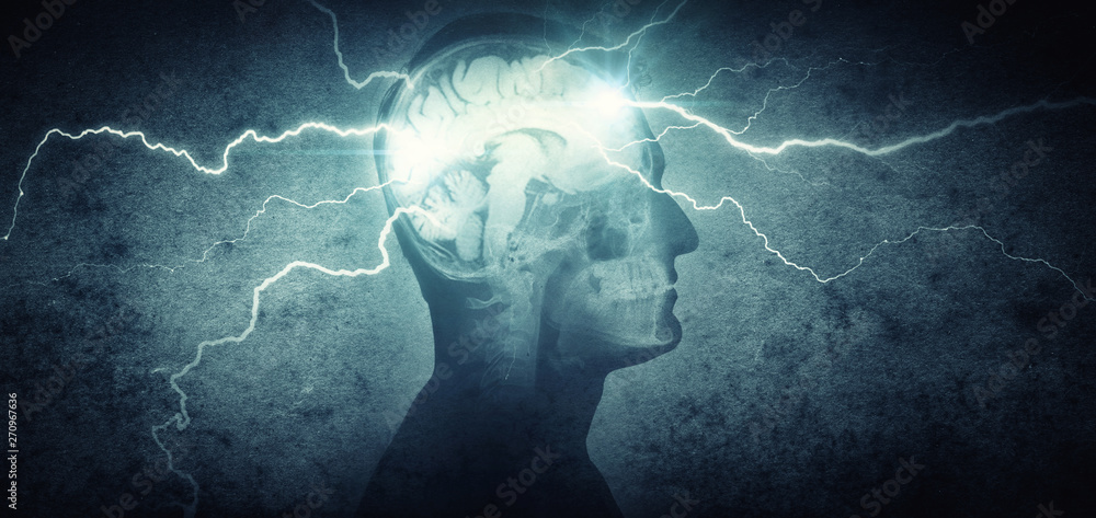 Silhouette of a man's head with x-rayed head and lightning coming out ...