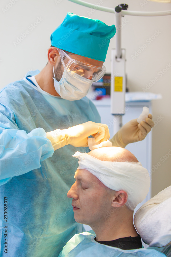 The surgeon gives injections to the head. Baldness treatment. Hair ...