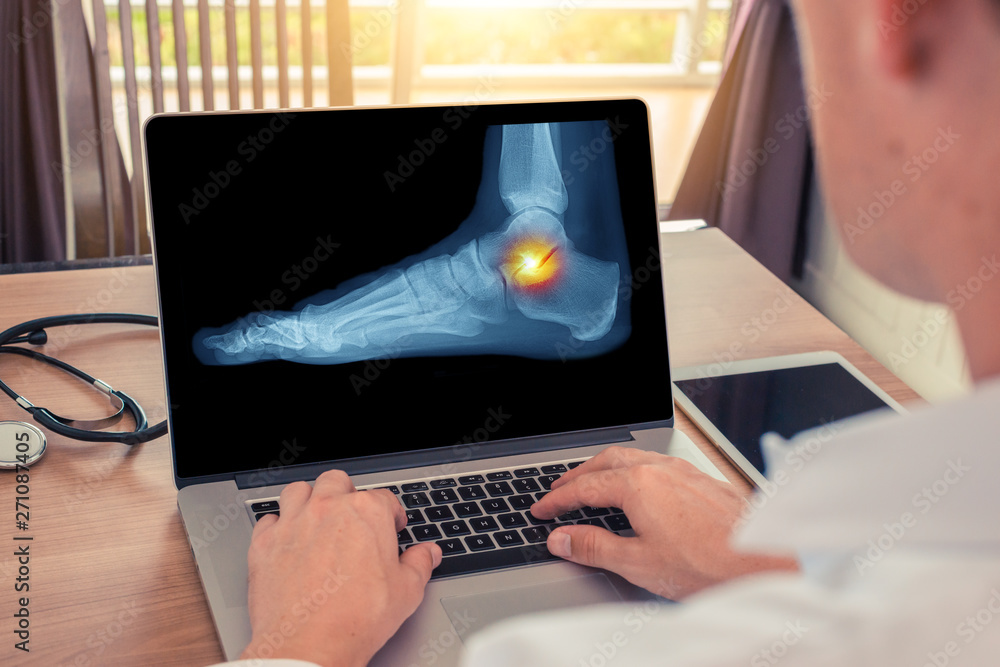 Doctor watching a x-ray of pain in the ankle of a foot. Radiology ...