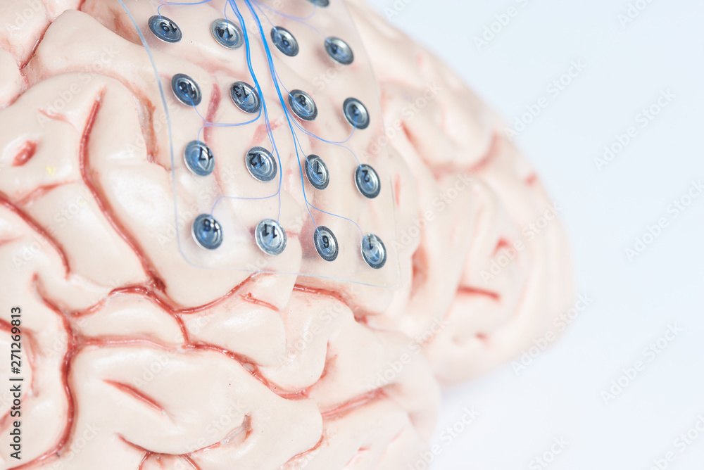 Subdural grid electrode for brain waves recording on the brain model ...