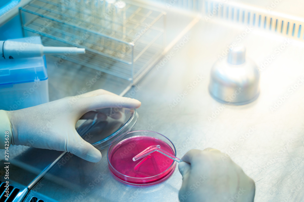Hands of scientists are working on research.Bacteria in agar sheets ...