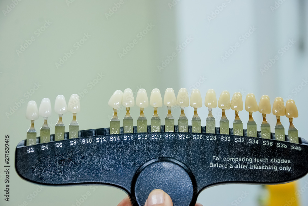 Dentist checking and selecting color of young man's teeth, closeup ...