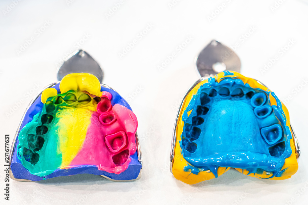 Plaster dental casts. Anatomical imprints of teeth. Denture. Dental ...