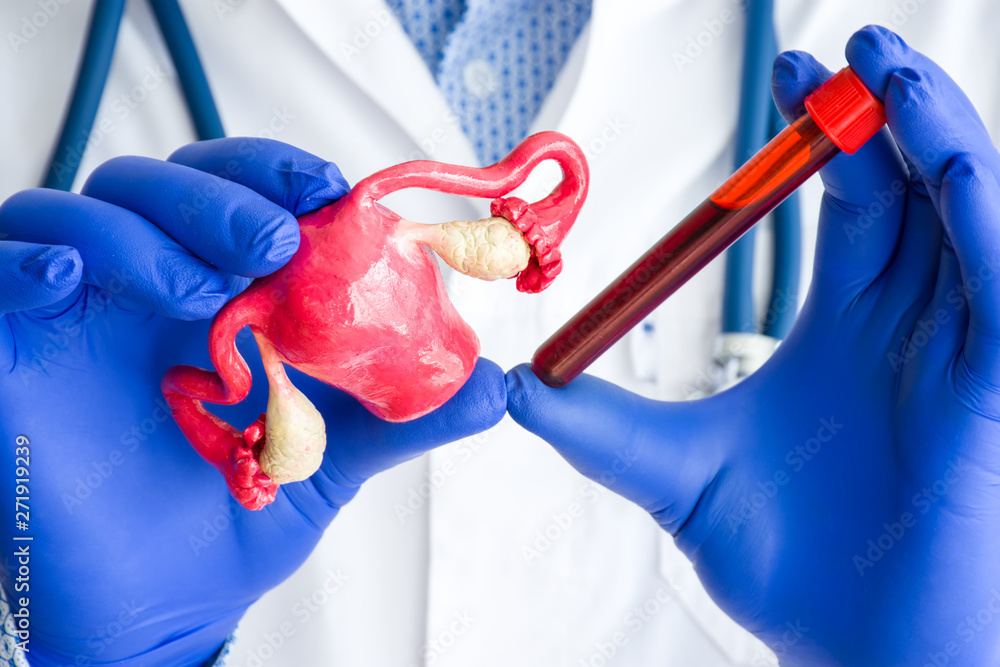 Laboratory medical diagnostics, tests and hormones for ovary and ...