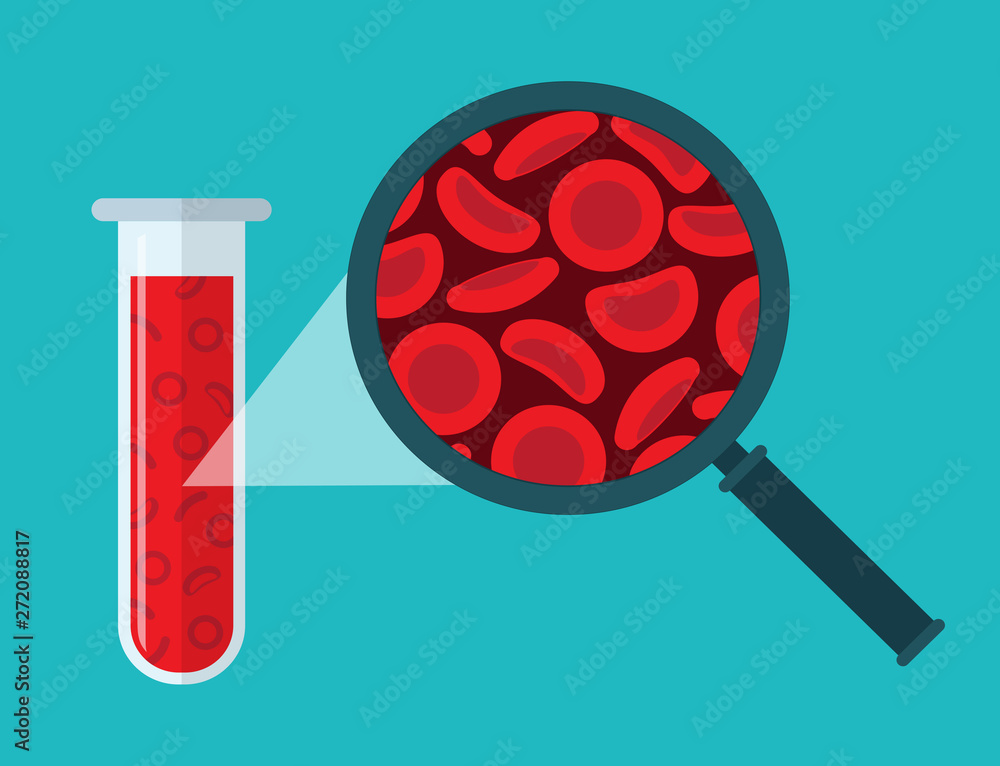 Red blood cells, Microscope and test tube. Blood concept. Human donates ...